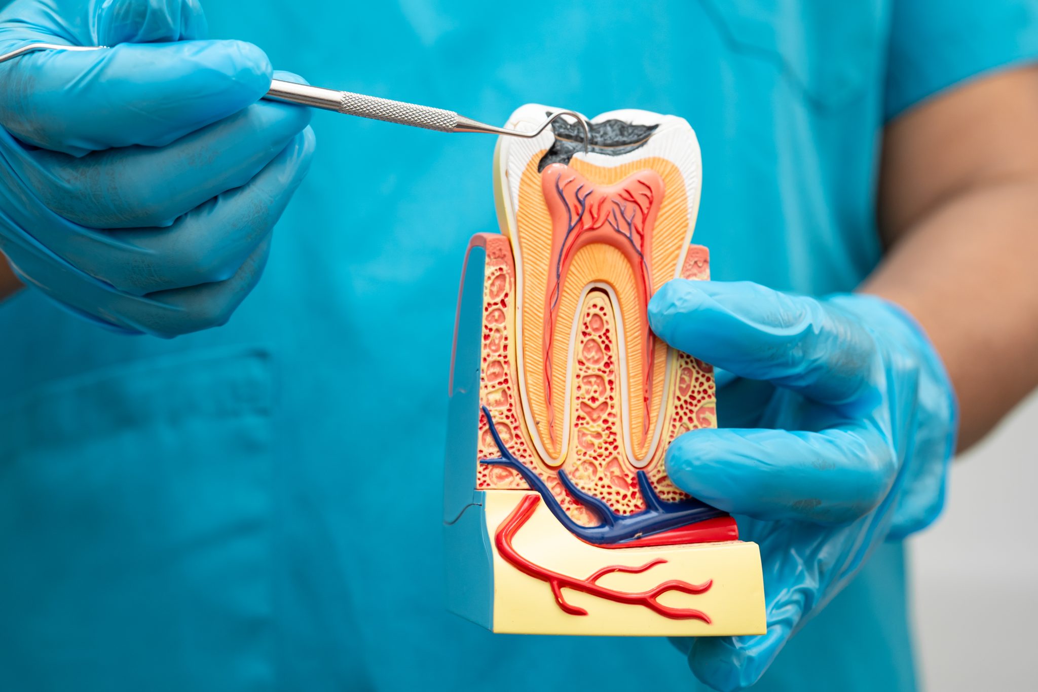 Is a Root Canal Painful? What to Expect - Tam Dental